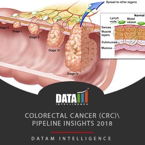 Colorectal Cancer | Pipeline Analysis | Future Outlook