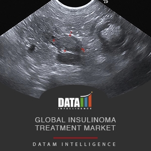 Insulinoma Treatment Market, Share & Growth | Analysis & Trend, 2020-2027